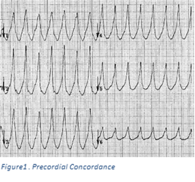 The Krannert Cardiology Handbook
